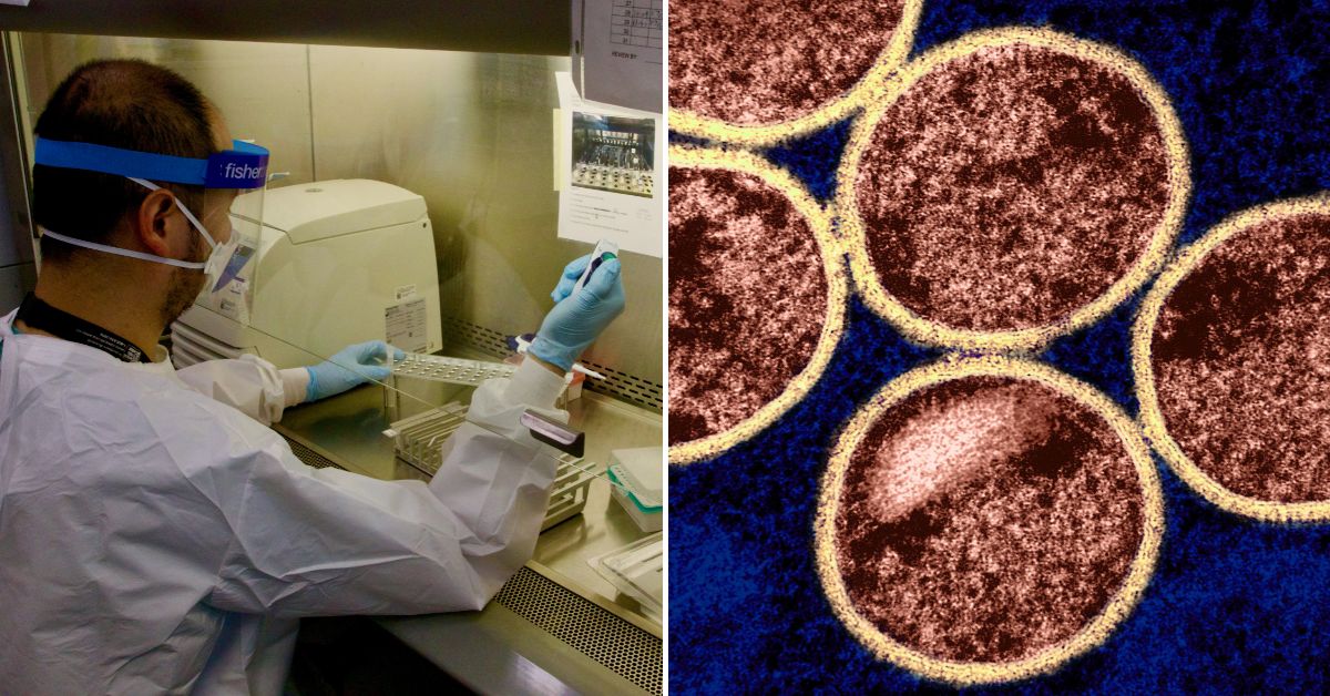 Mpox Outbreak in Pakistan: Health Emergency Declared as Cases Rise